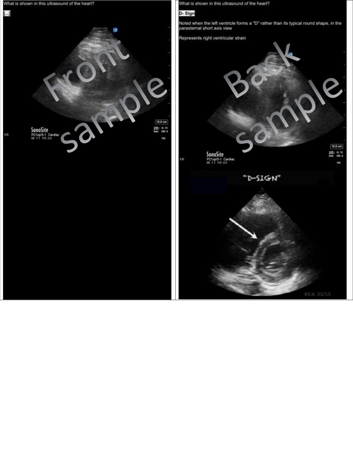 4 Best Radiology Anki Decks: Learn Radiology Fast (2021) – willpeachMD