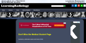 7 Best Free Radiology Learning Websites (2021) – willpeachMD